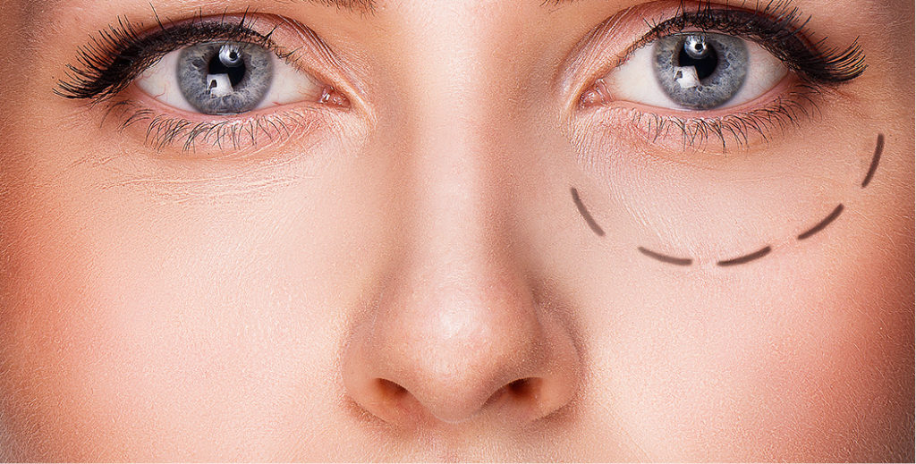 St. Clair Cosmetic ClinicLook Brighter, Younger with Under Eye and ...