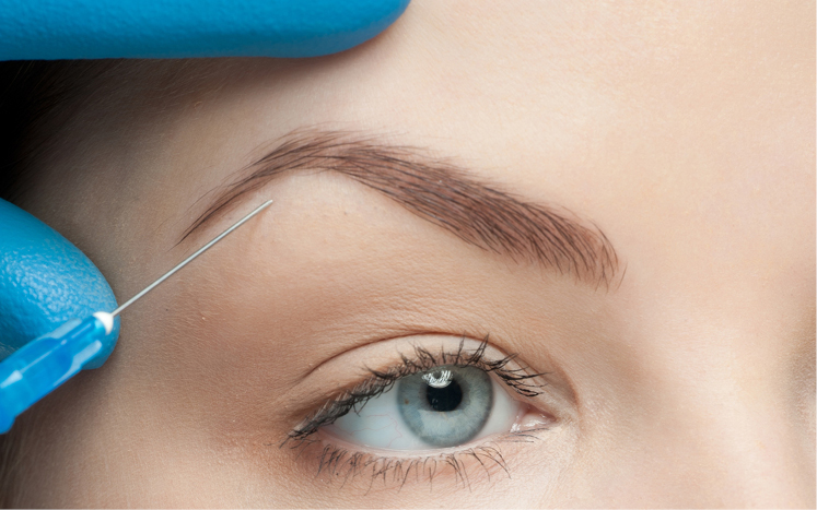 St. Clair Cosmetic ClinicBotox Eyebrow Lift: Non-Surgical Treatment for ...